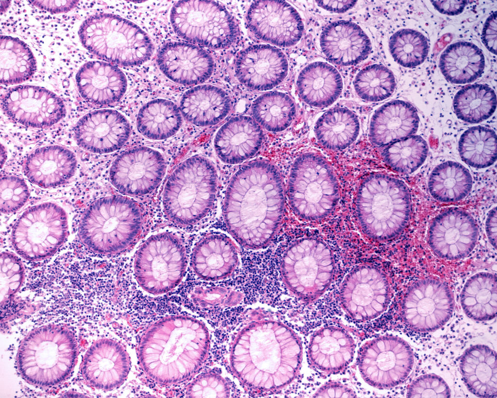 Advances in ex-vivo tissues preparation for microindentation