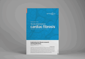 The role of Mechanics in cardiac fibrosis - Optics11 Life
