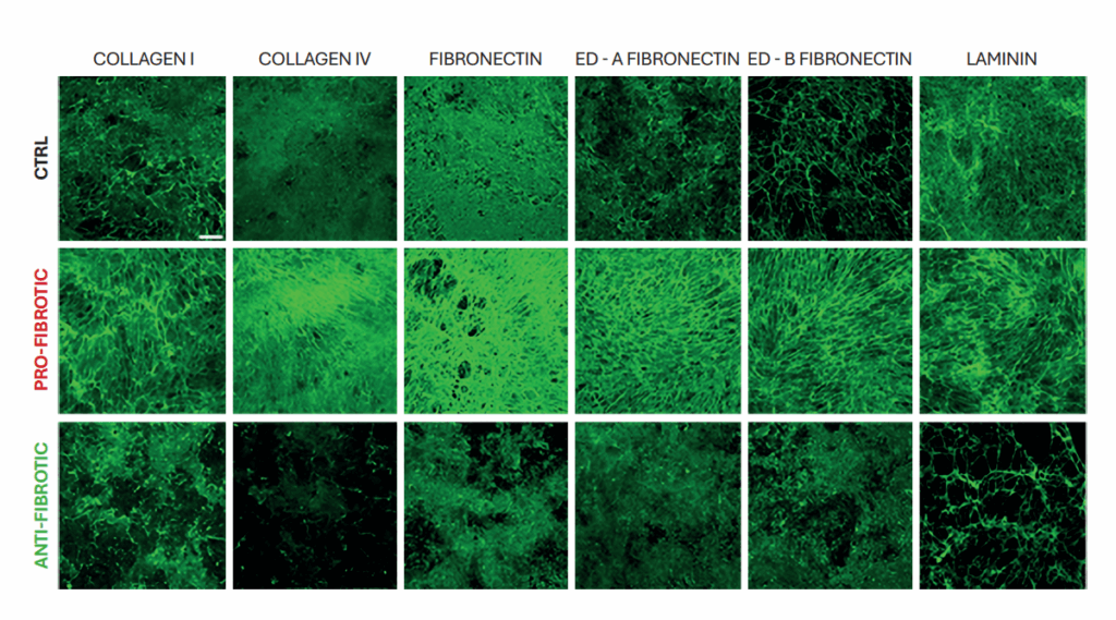 The role of Mechanics in cardiac fibrosis - Optics11 Life